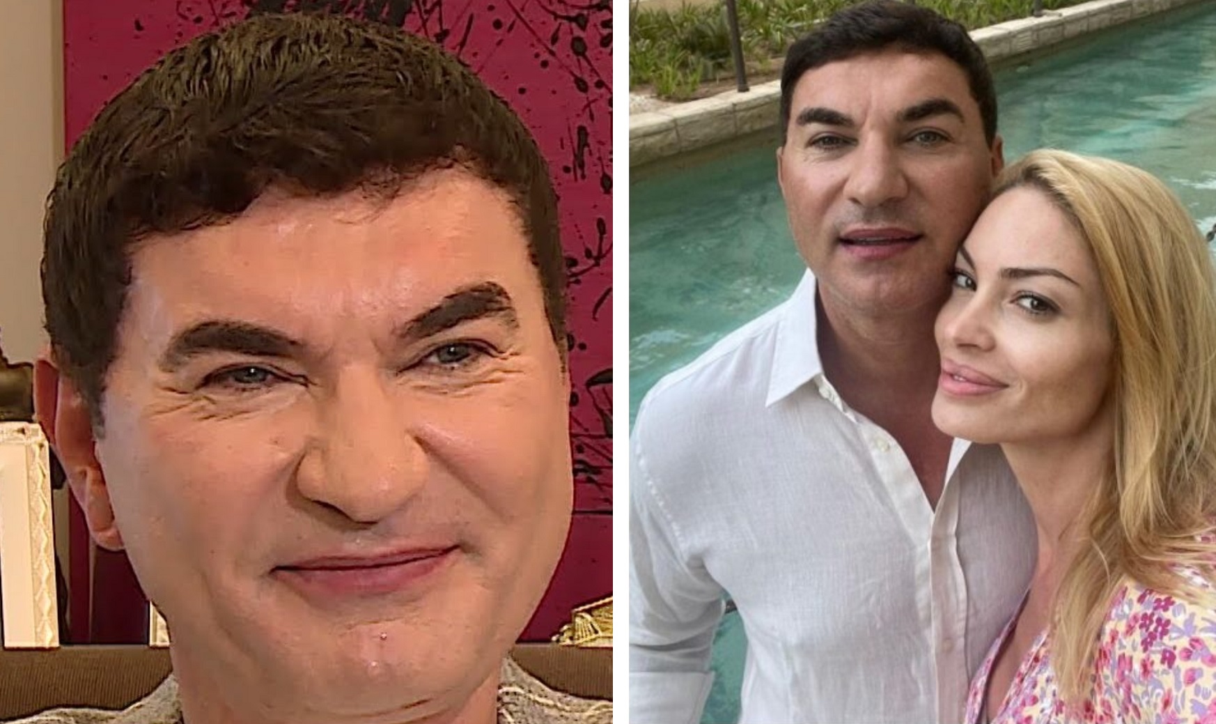 Ce e „Sculptra”, procedeul la care a apelat Cristi Borcea pentru a ...